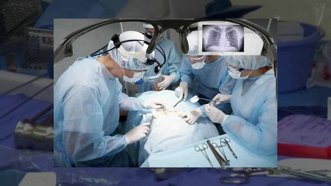利用 Google Glass 進行手術，全球名醫都是你的智囊團 | T客邦