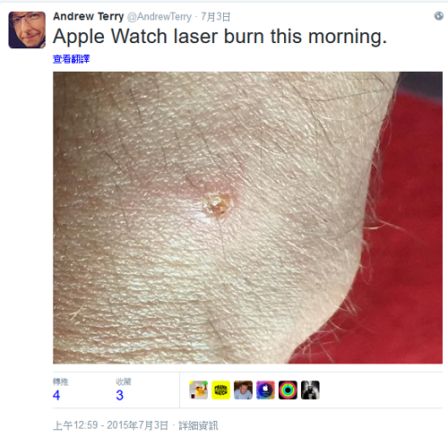 部分使用者報告被 Apple Watch 燙傷 | T客邦