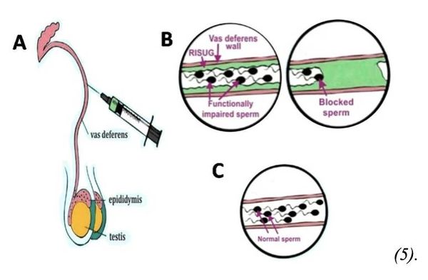 今年開始人體試驗，男性避孕藥真要來了 | T客邦